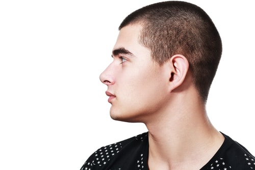 What jaw surgery may be performed by our oral surgeon? - Sultan Center ...